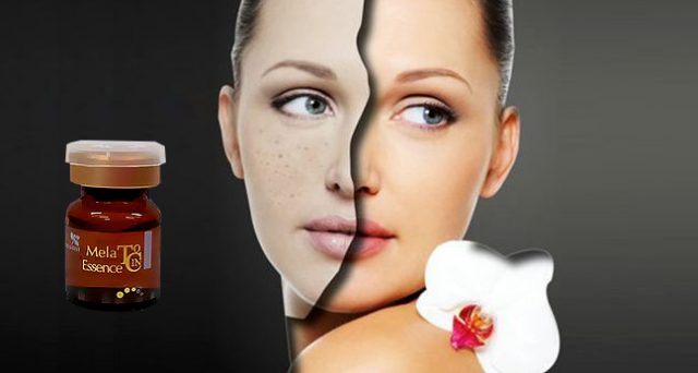 Melasma injection treatment : Melatocin Essence for Melasma Treatment ...
