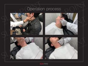 New lipodissolve solution Slim Point Lipolysis Injection compares to ...